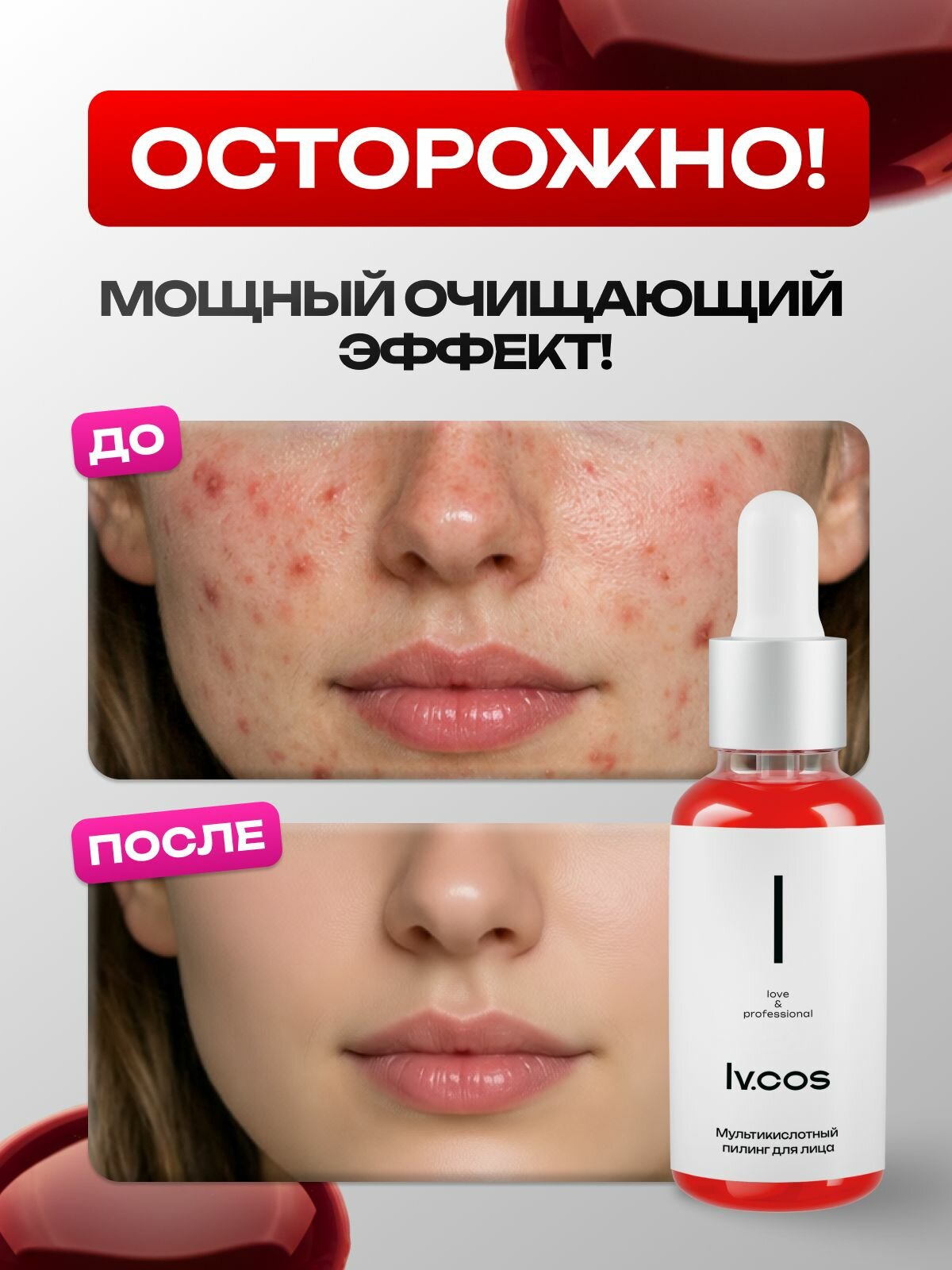 Пилинг для лица кровавый с кислотами, Iv.cos