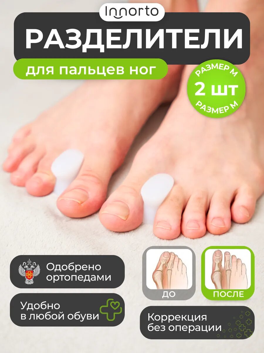 Разделители «INNORTO», артикул 44138, типоразмеры М - 1 пара;