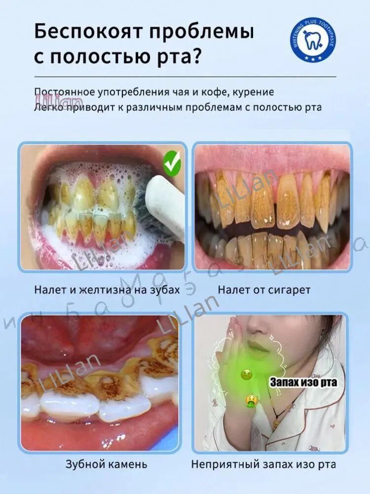 Зубная паста — фото 1
