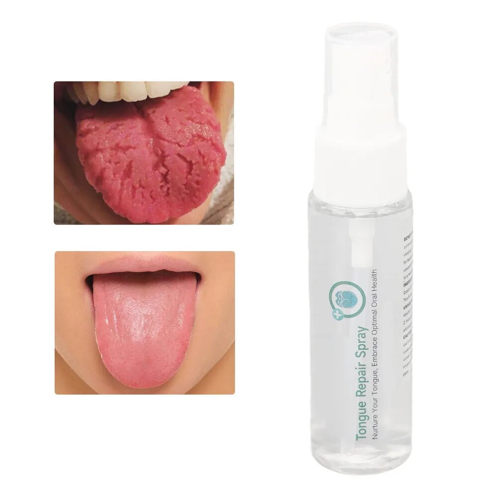 Спрей для восстановления языка