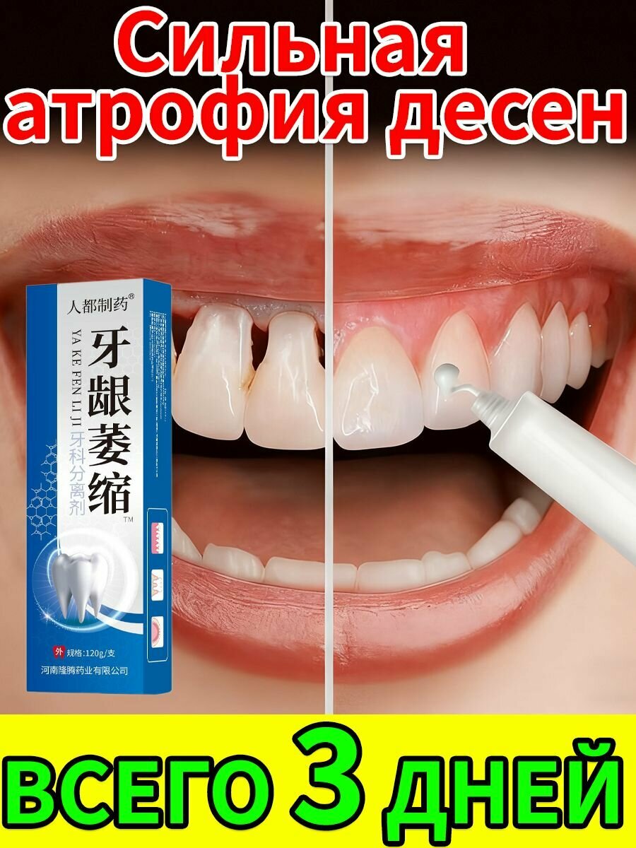 Зубная паста для рецессия десны Для укрепления и восстановления зубов, десен и эмали, от воспаления и кровоточивости десен, для удаления налета