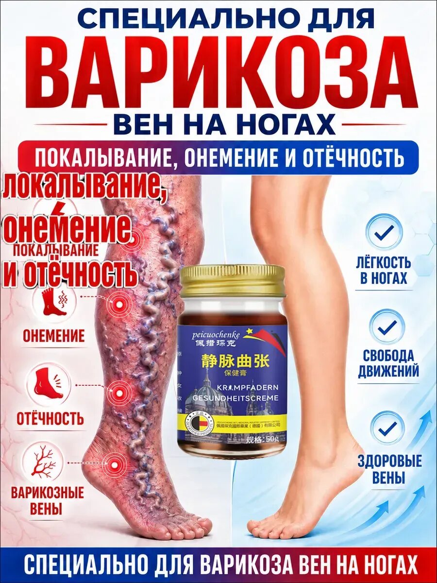 От варикоза вен на ногах