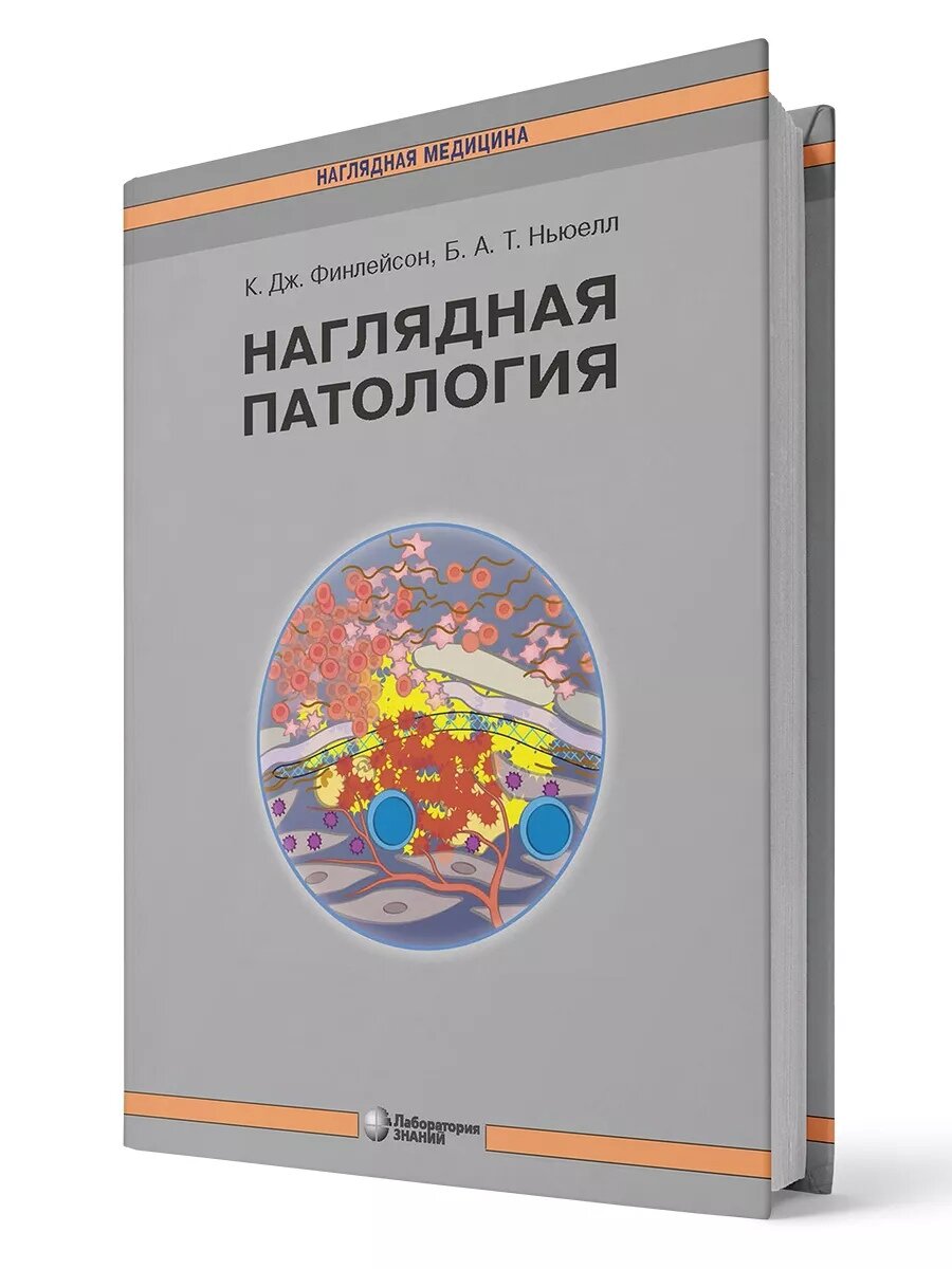 Наглядная патология / Финлейсон К. Ньюэлл Б.