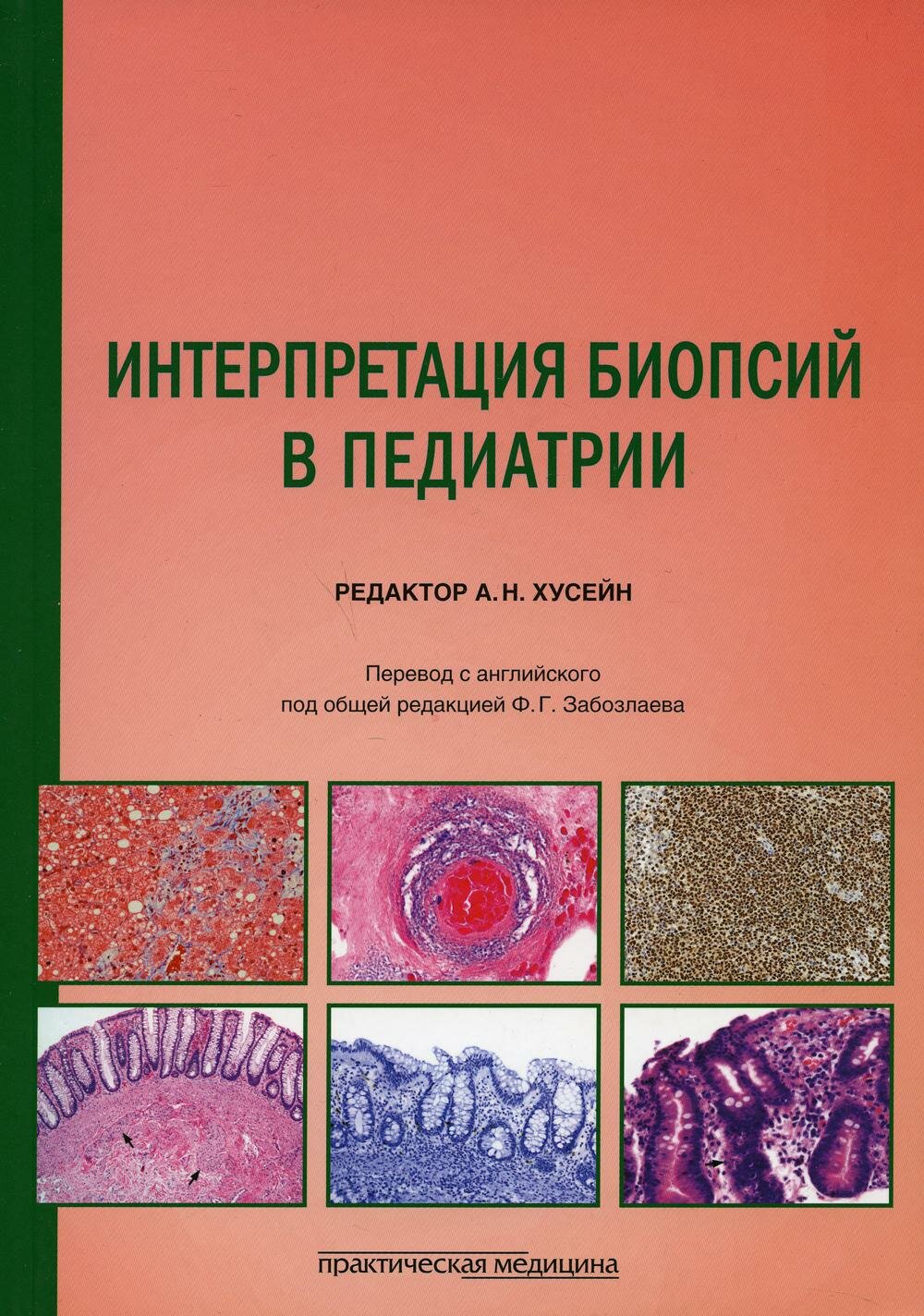 Книга Практическая медицина Интерпретация биопсий в педиатрии. 2019 год, А. Н. Хусейн
