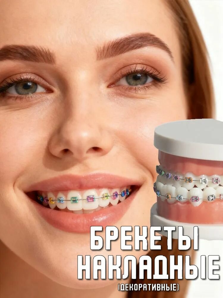 Брекеты накладные металлические для зубов