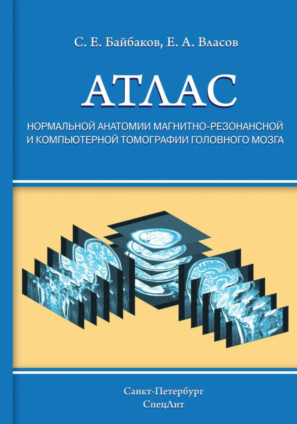 Атлас нормальной анатомии магнитно-резонансной и компьютерной томографии головного мозга.，печатная книга переиздания