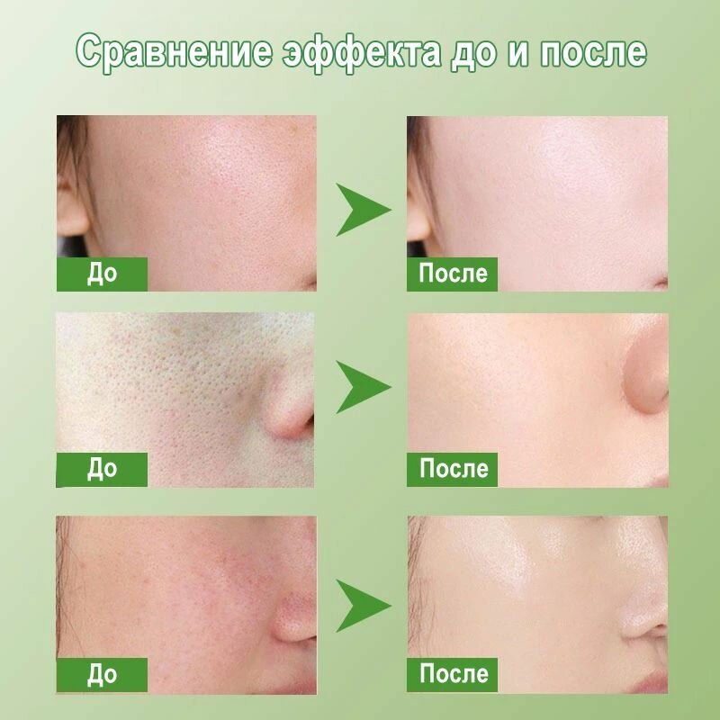 Сыворотка для лица — фото 1