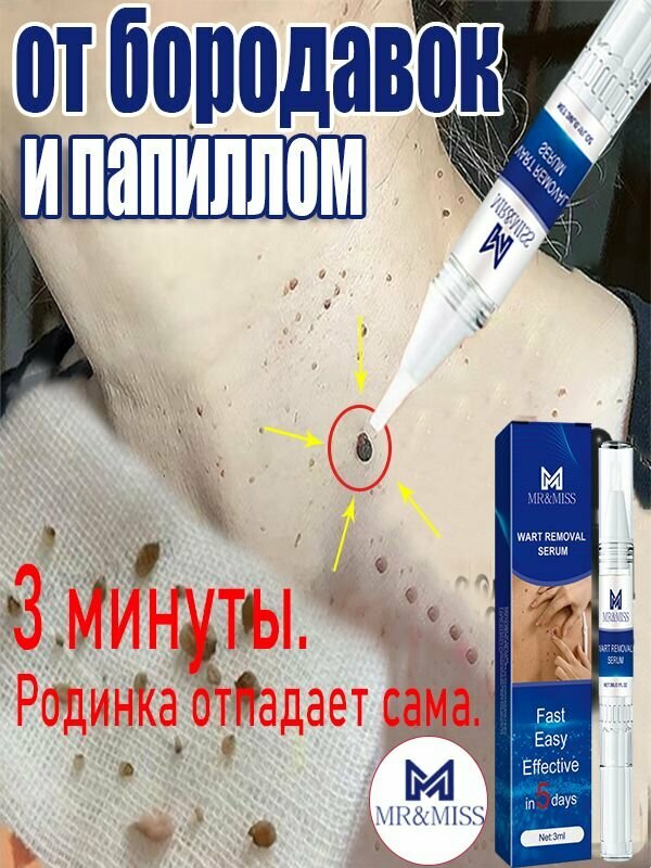 MR&MISS карандаш от папиллом и бородавок 3 мл, папиллом и родинок без боли и следов. Без побочных эффектов