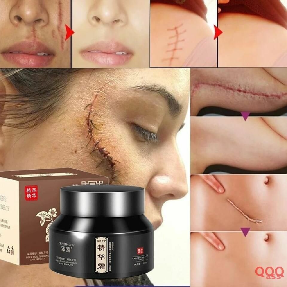 Средство от растяжек ass