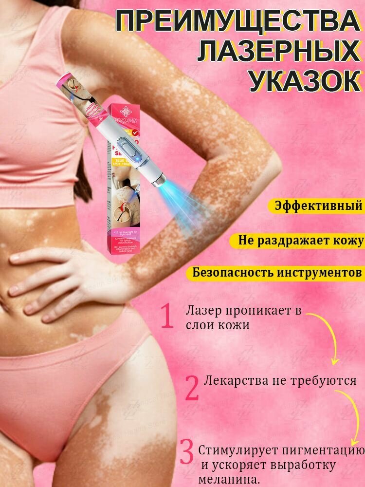 Лазерное лечение витилиго эффективно удаляет белые пятна, лечит витилиго, регулирует пигментацию, выравнивает тон кожи и подходит для чувствительной кожи. 1 шт.