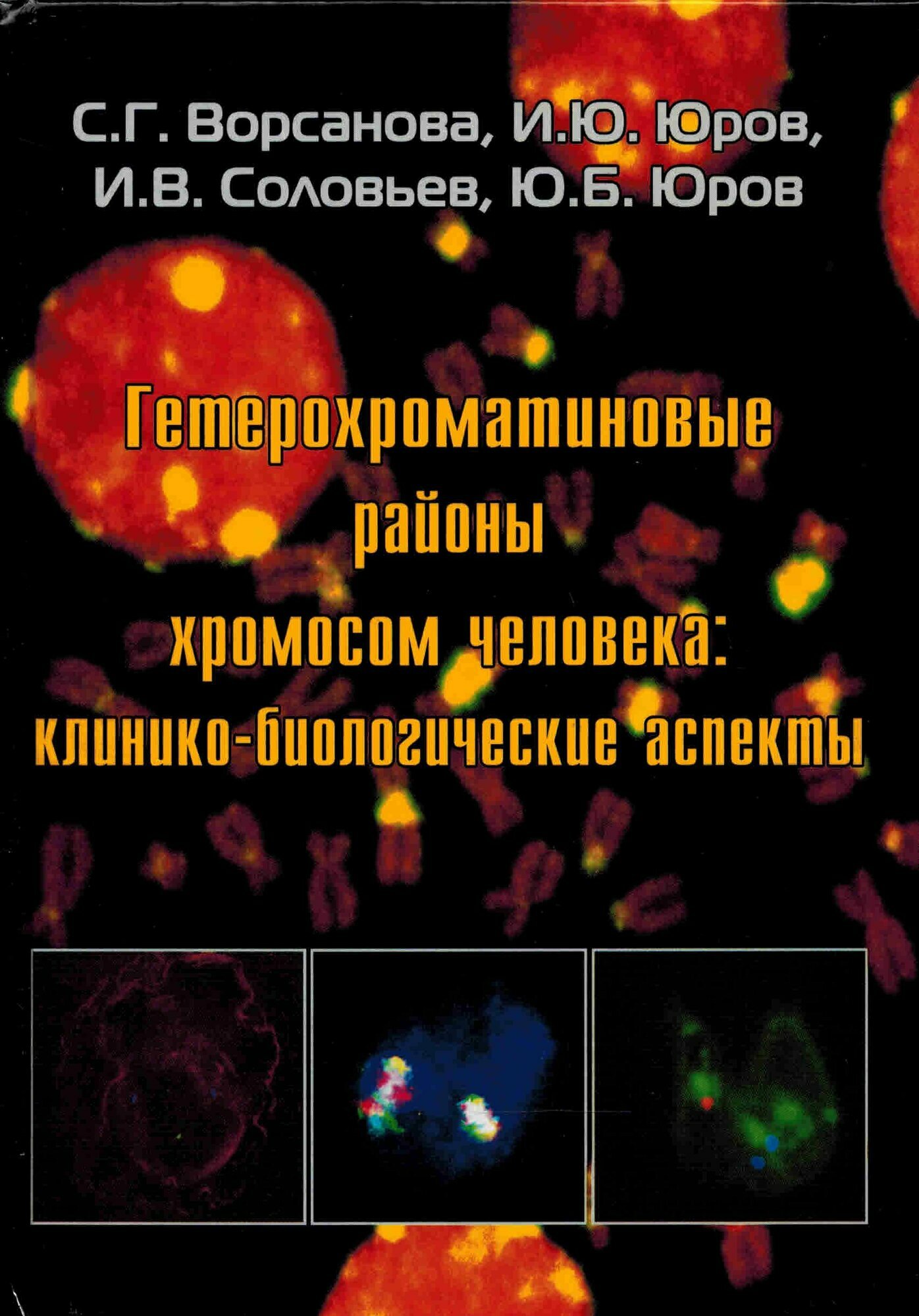 Гетерохроматиновые районы хромосом человека: клинико-биологические аспекты