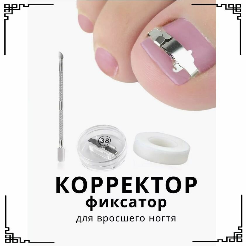Набор для выпрямления и коррекции вросшего ногтя