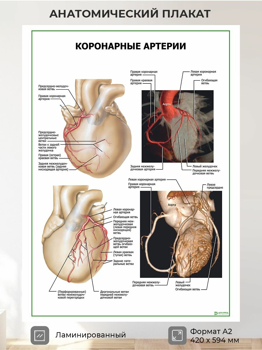 Обучающий медицинский плакат ламинированный формат А2 Коронарные артерии