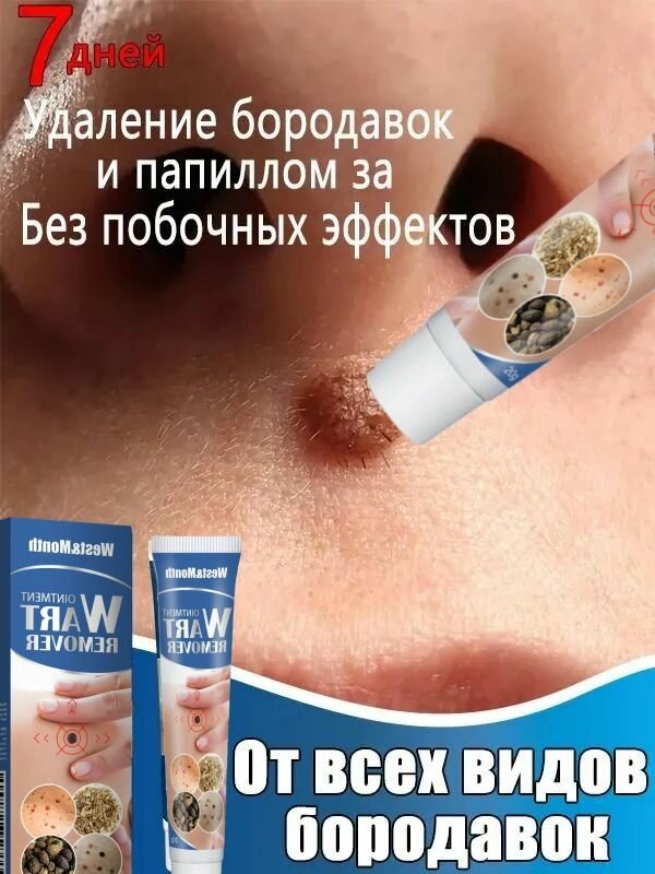 Крем для лечения папиллом и бородавок, эффективно лечит родинки, папилломы и разные виды бородавок. Безболезненно, без следов, без побочных эффектов, безопасно и эффективно. 20 г