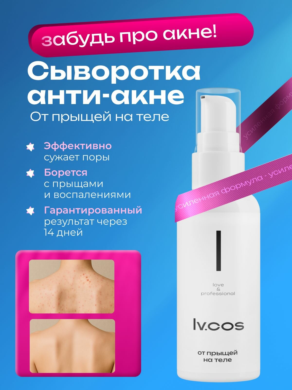 Сыворотка от прыщей на спине и теле , LV. COS