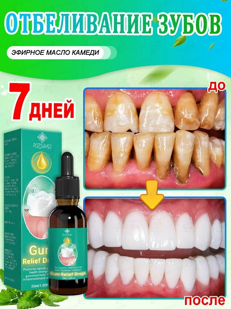 Эфирное масло для ухода за зубами. Быстро устраняет рецессию, покраснение и отёк дёсен, укрепляет корни зубов и снижает чувствительность зубов. Не раздражает слизистую оболочку полости рта. 150 мл.