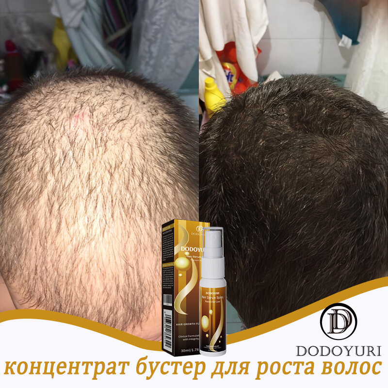 Мощный для роста волос спрей для роста волос, восстановление корней, средство против выпадения 30мл