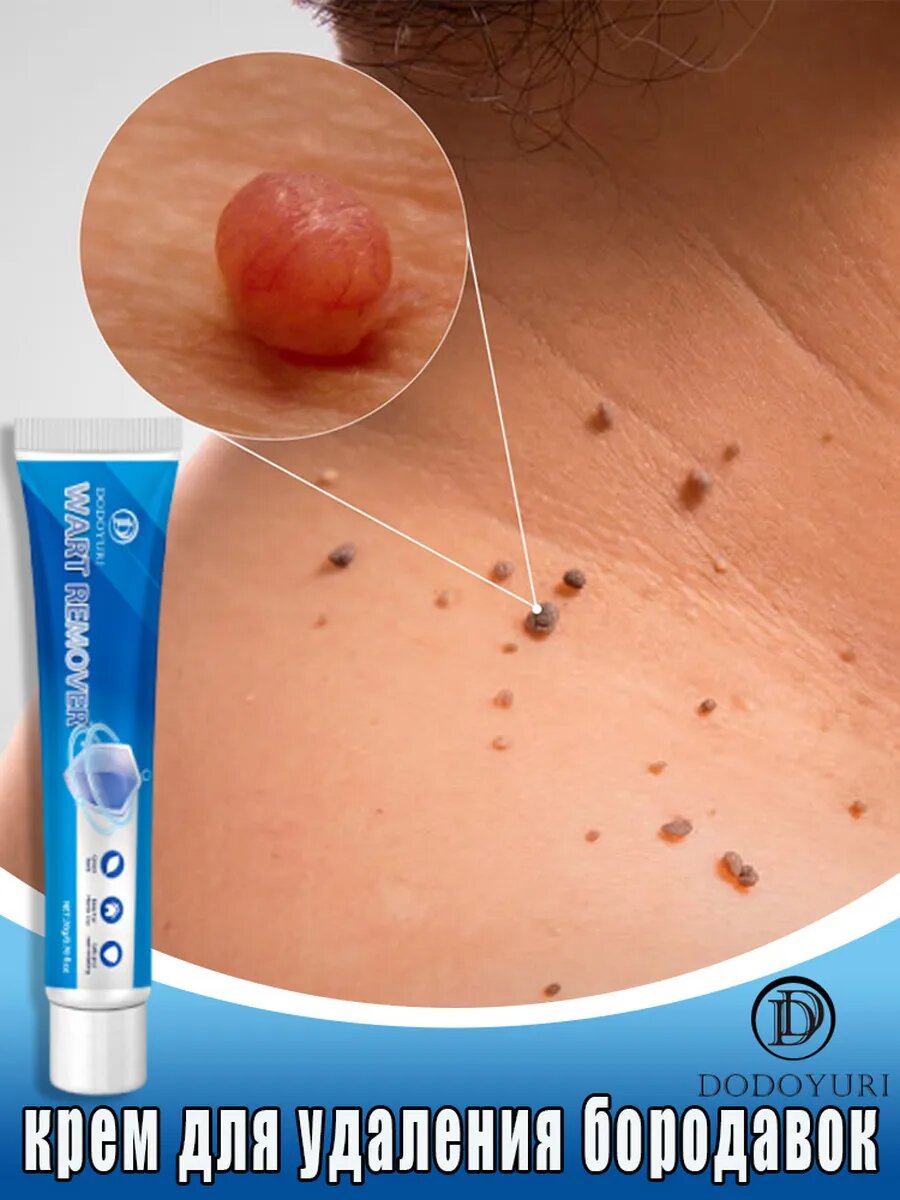 Крем косметиЧеский локального применениЯ от паппилом и бородавок, Средство от папиллом и бородавок DODOYURI гель ,20г