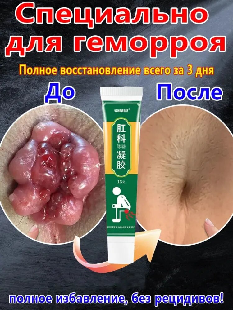 Мазь от геморроя Китайский гель от геморроя