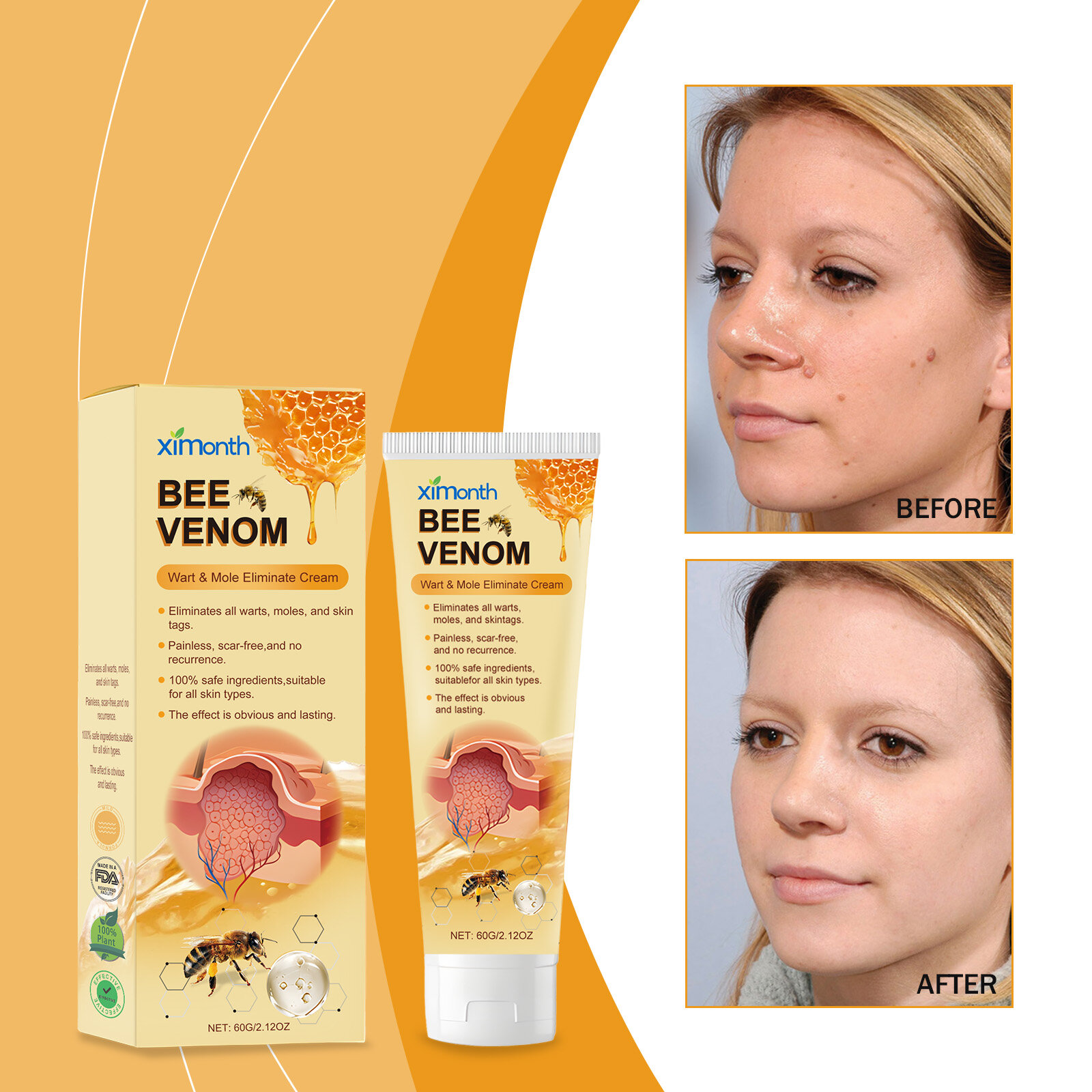 Ximonth от папиллом и бородавок гель оригинал, для тела, для рук, для шеи, чистотел от бородавки, мазь от сухих мозолей 60 г