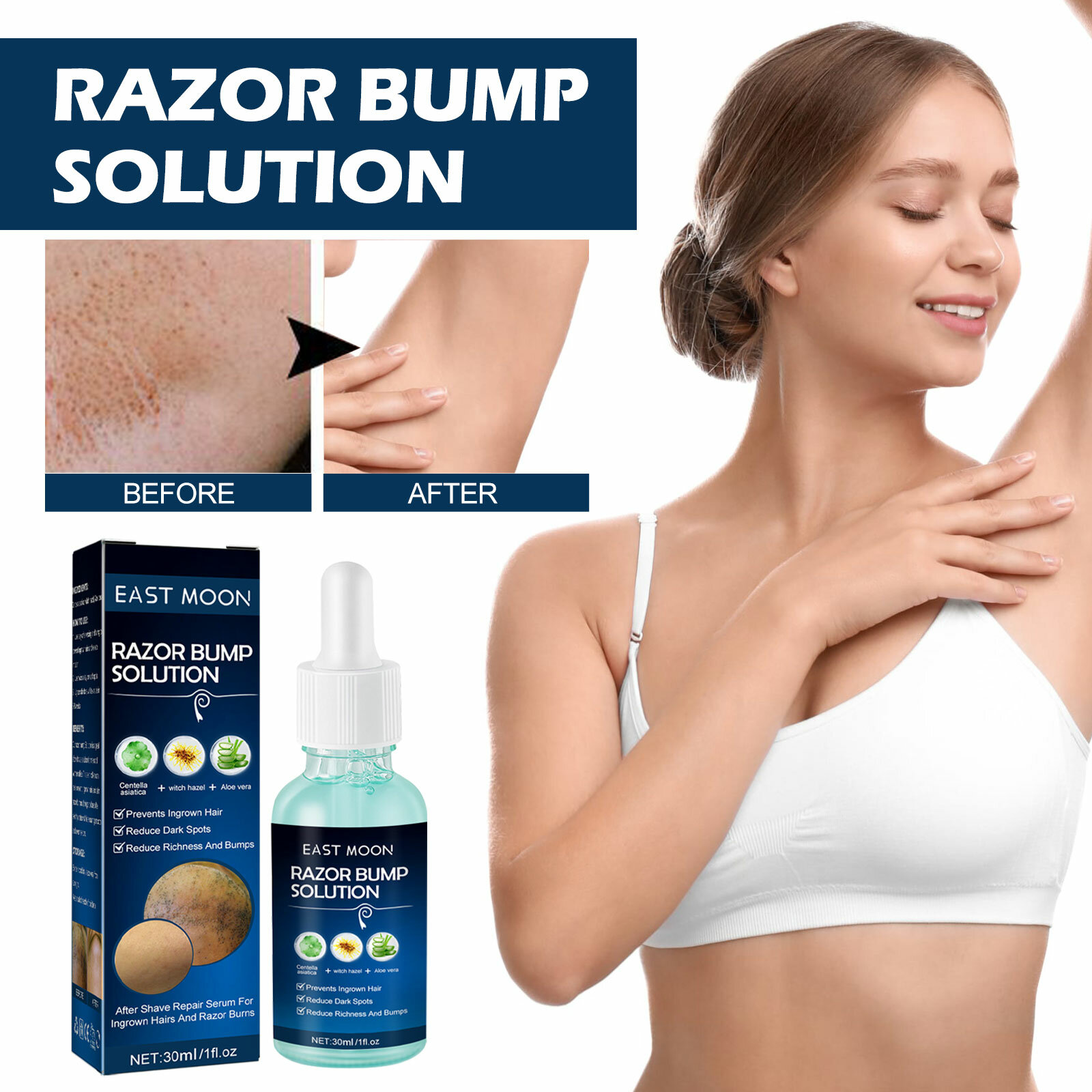 Сыворотка Против Вросших Волос Нежный Увлажняющий Уход За Бородой Для Восстановления Вросших Волос На Теле