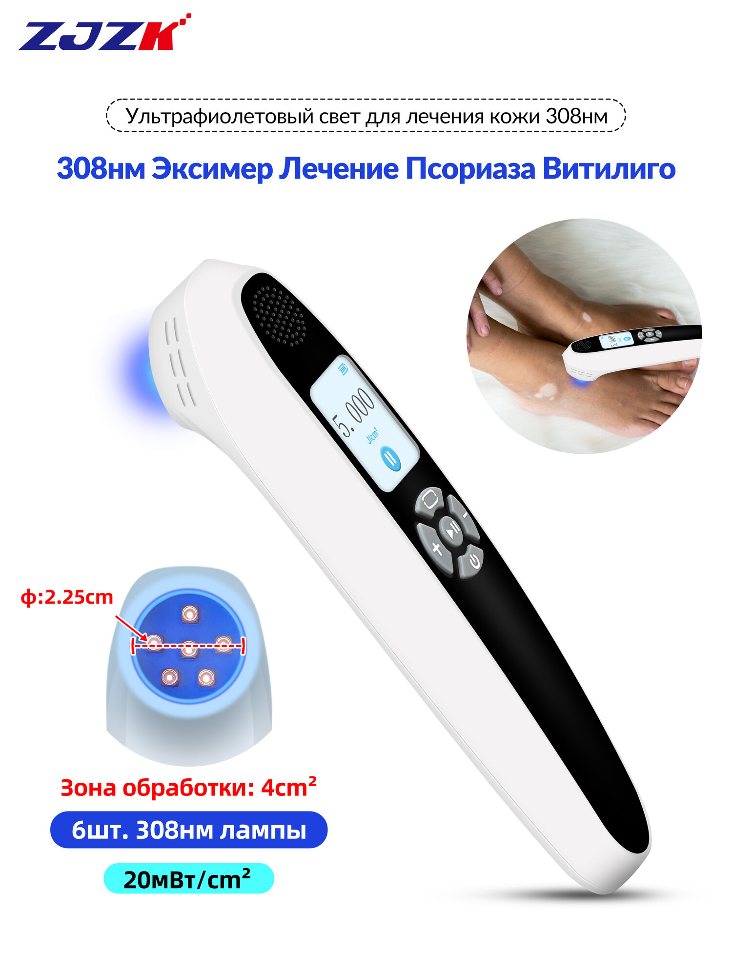 Эксимерный лазер 308 нм NB UVB точечная терапия домашняя витилиго псориаз экzema