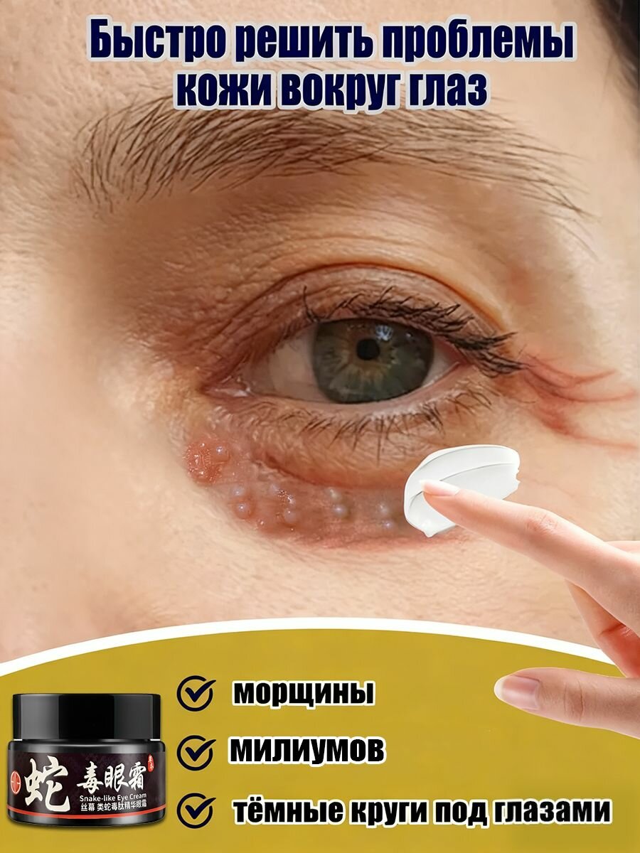 Средство от милиумов на лице, ARAVIA Крем для антивозрастной, для зоны вокруг глаз, от темных кругов и морщин, отёков вокруг глаз, с эффектом лифтинга 30 г