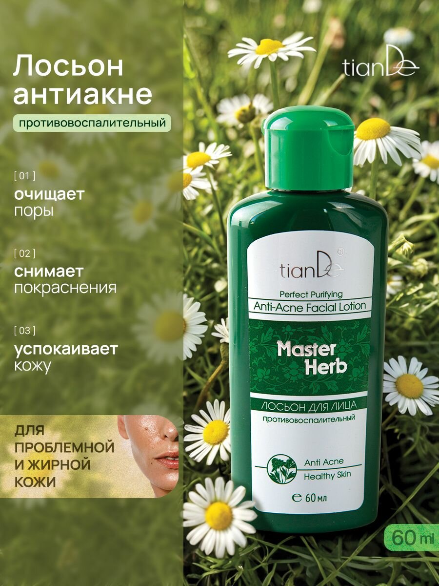 TianDe Лосьон для лица от прыщей, акне и черных точек очищающий, противовоспалительный для проблемной кожи Master Herb, 60 мл