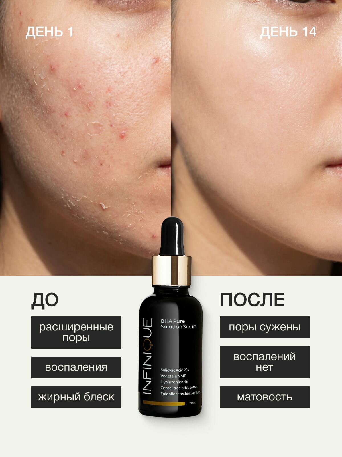 INFINIQUE сыворотка для лица с салициловой кислотой BHA Pure Solution Serum, от прыщей, 30мл