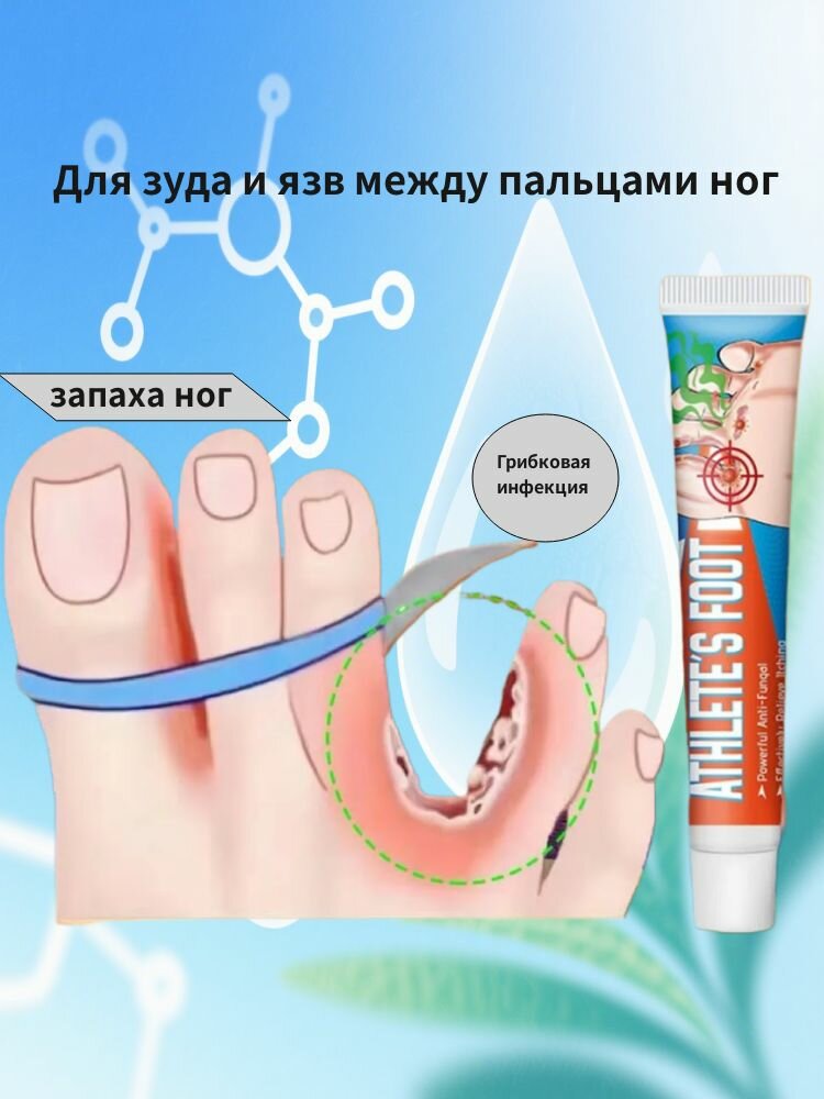 Средство от запаха ног для зуда и язв между пальцами, против грибка, дезодорант эффективное 20г