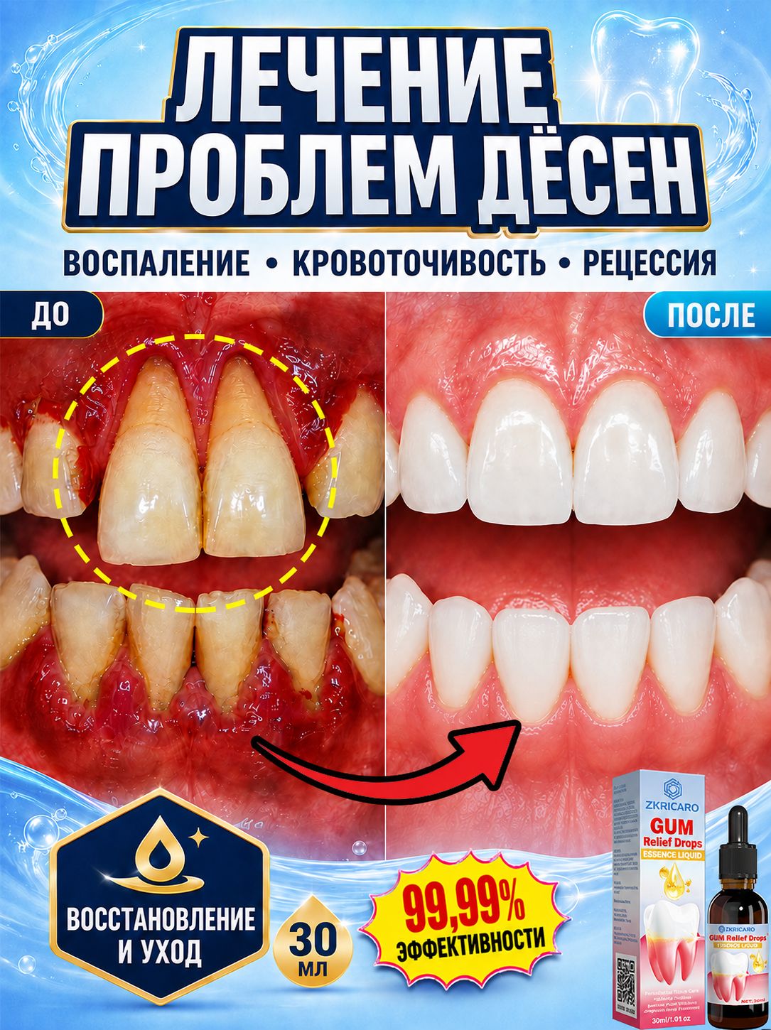 Стоматологическое масло для десен при кровоточивости, воспалении и чувствительности зубов, укрепление десен, уход за полостью рта, свежесть дыхания, 90 мл