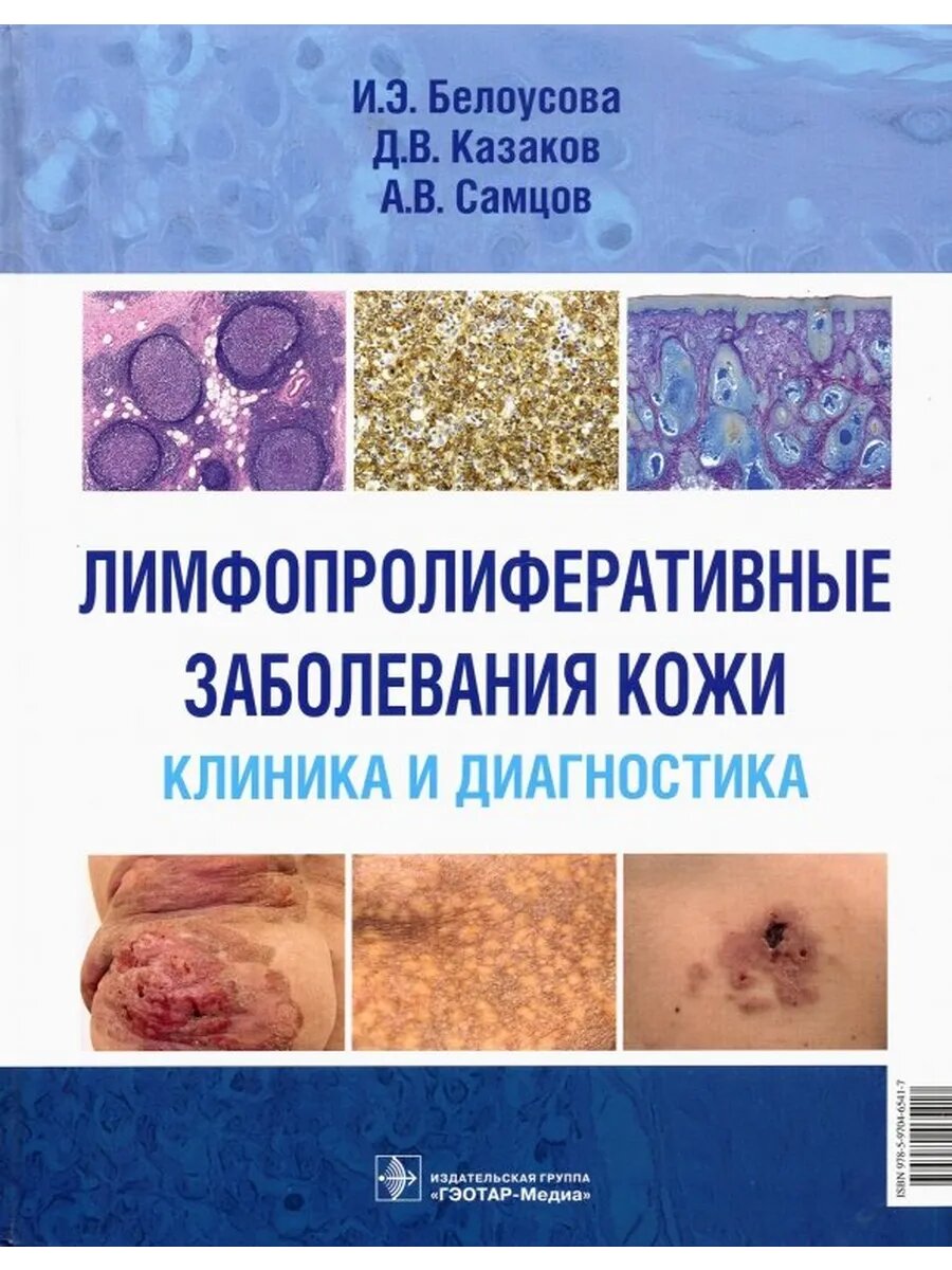 Лимфопролиферативные заболевания кожи. Клиника и диагностика