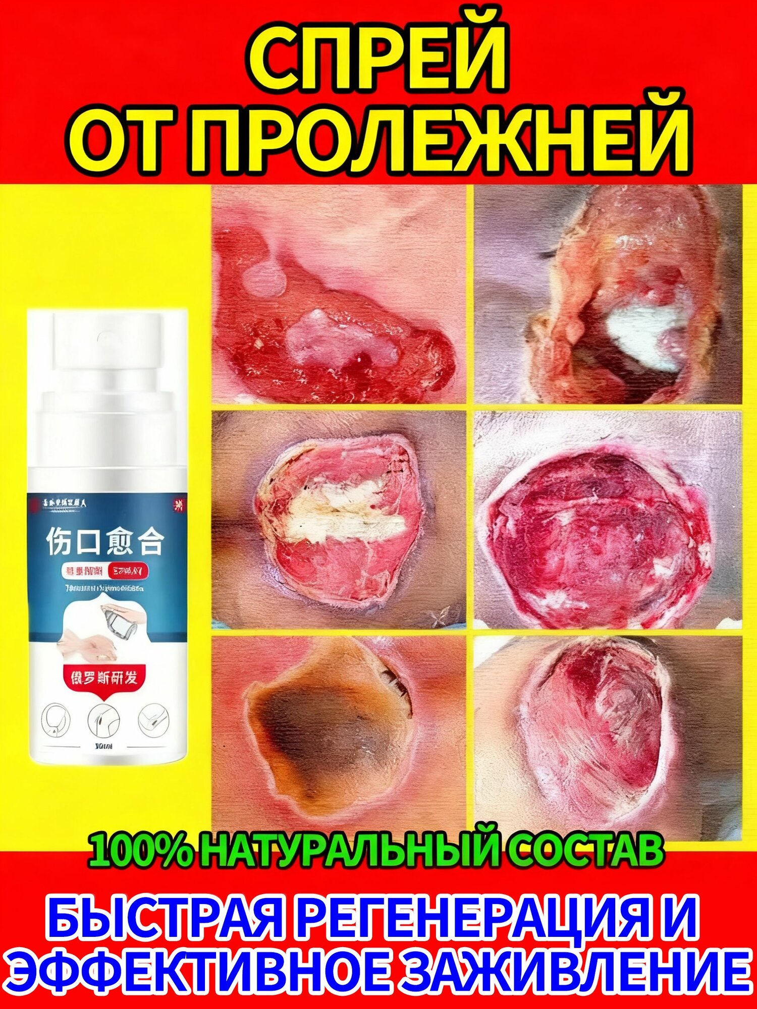 Спрей заживляющий от пролежней для лежачих больных 30 мл