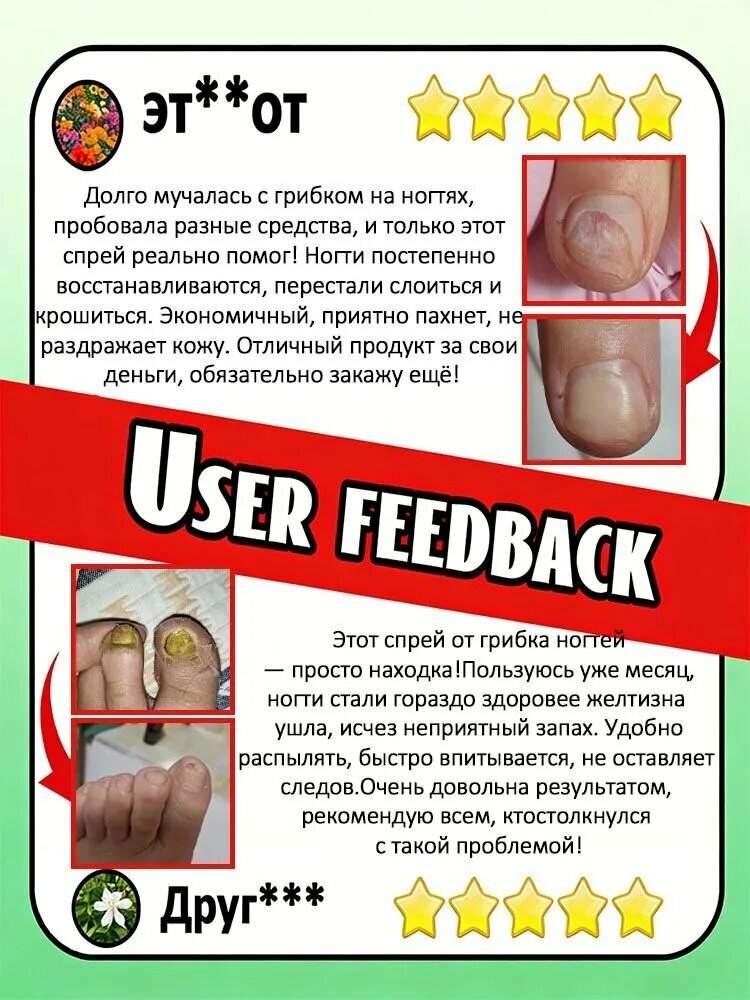 Спрей от грибка ногтей с натуральными ингредиентами для лечения грибковых инфекций и онихолизиса, способствующий восстановлению и росту ногтей / 90 мл