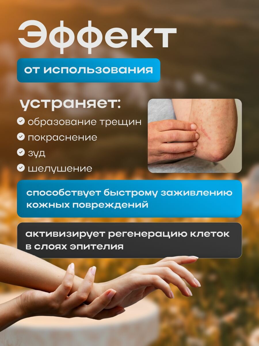 Крем от псориаза, дерматита , сухости и шелушения кожи лица и тела Zudaifu заживляющий, мазь для рук и ног , лечение трещин и экземы и прыщей и лишая, средство от раздражения и зуда