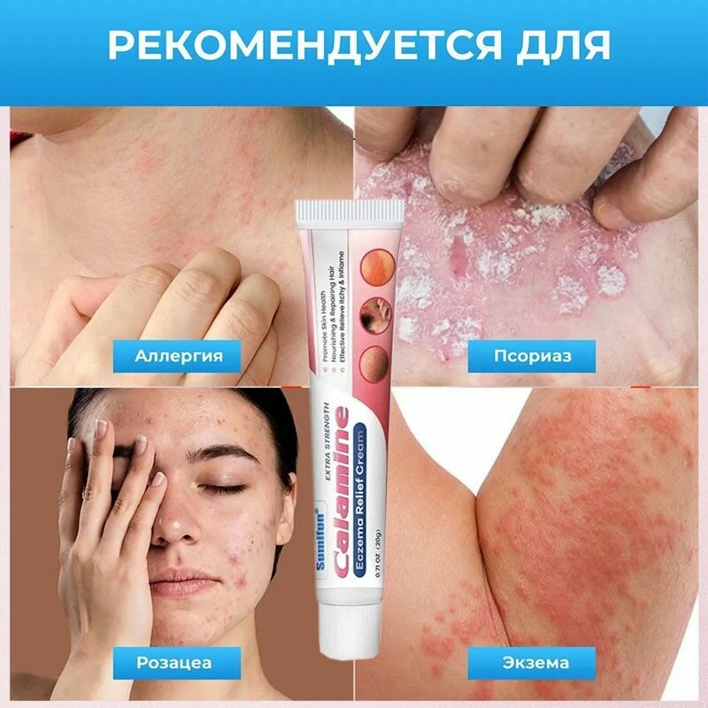 Крем для ухода за кожей при псориазе, экземе и герпесе, акне, ожогах, порезах,20 г