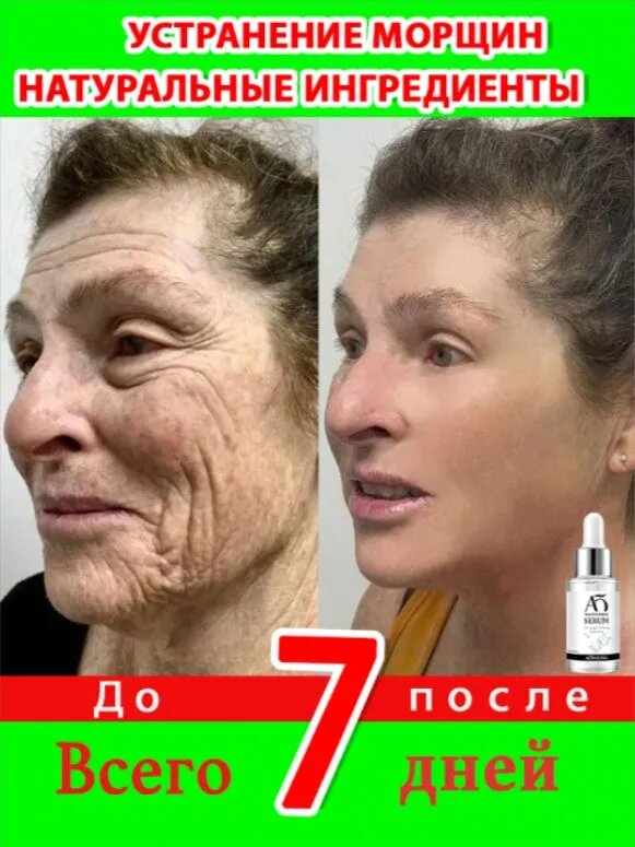 Натуральное антивозрастное эфирное масло для лица и тела, разглаживающее морщины и повышающее упругость кожи,30 г