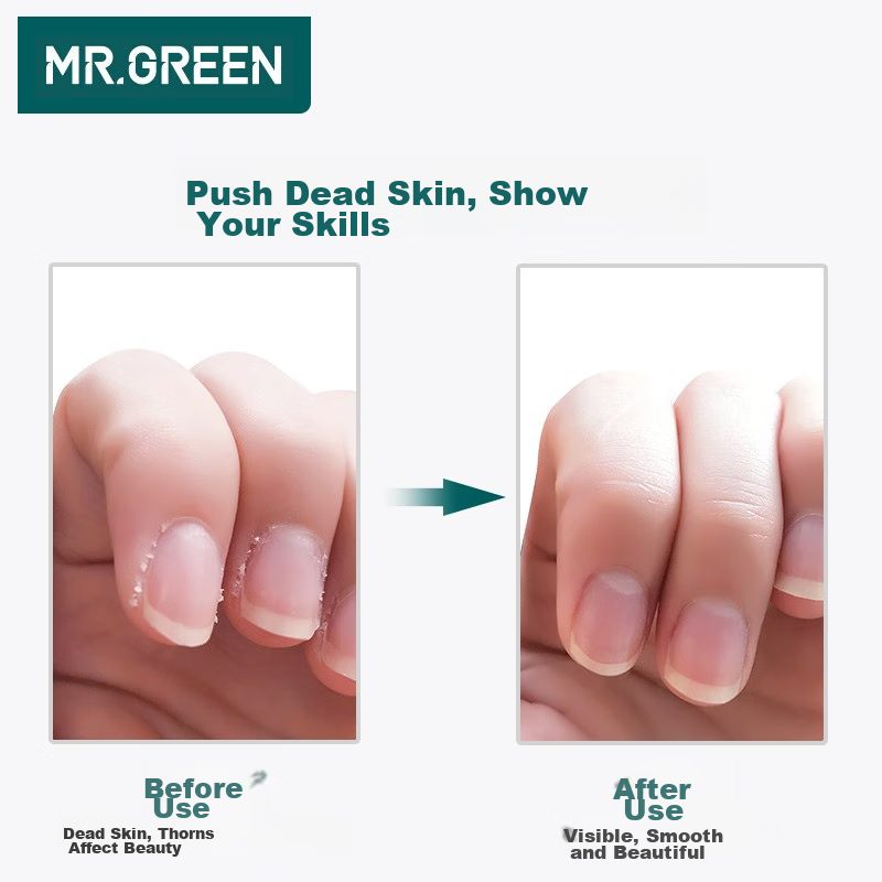 MR.GREEN German Dead Skin Fork, Dead Skin Pusher, Dead Skin Steel Scraper, V-Shaped Dead Skin Remover, Callus Remover, Manicure Tool, Stainless Steel, Mr-2109
