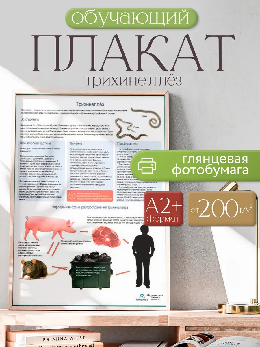 Трихинеллёз медицинский плакат А1+/A2+ (глянцевая фотобумага от 200 г/кв. м, размер A2+)