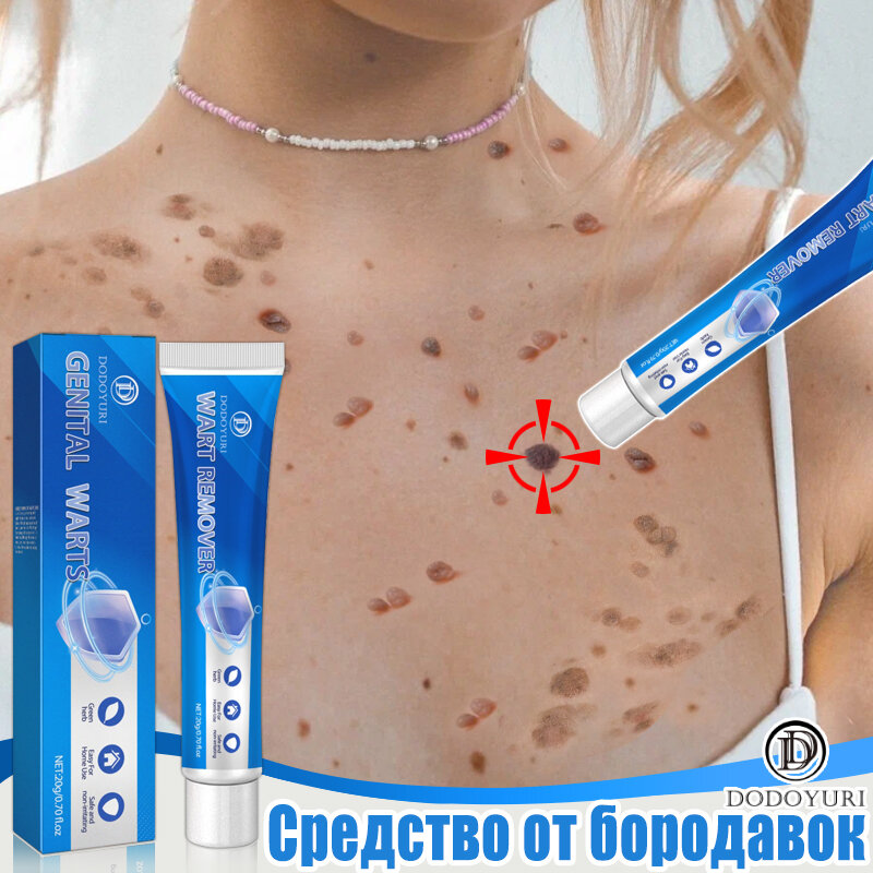 DODOYURI / Мазь от бородавок, Крем средство для удаления бородавок, папиллом и родинок, безболезненно, не оставляет следов / 20г от бородавок средство