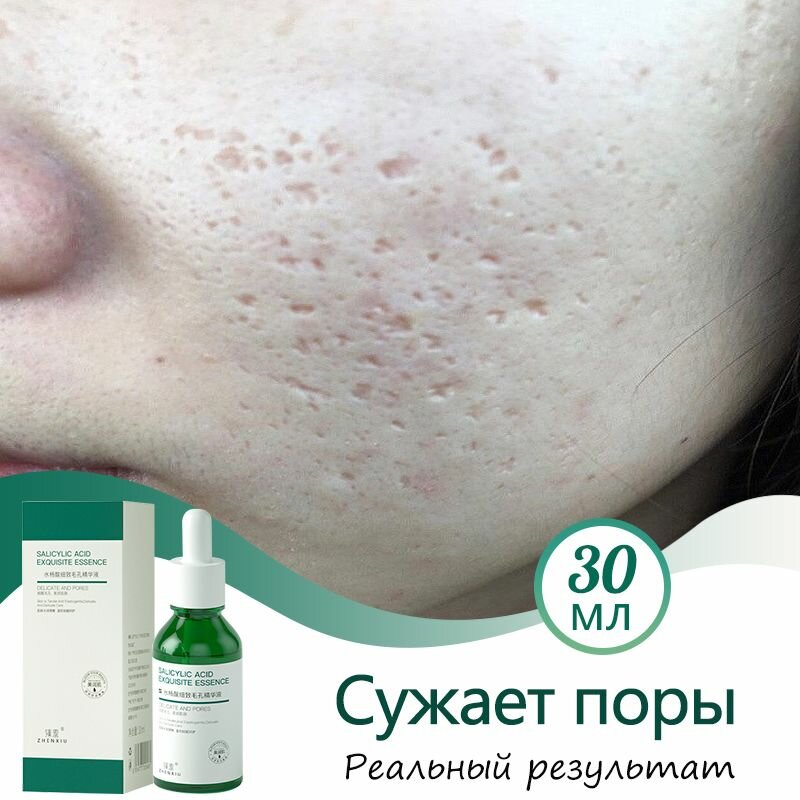 Сыворотка для лица