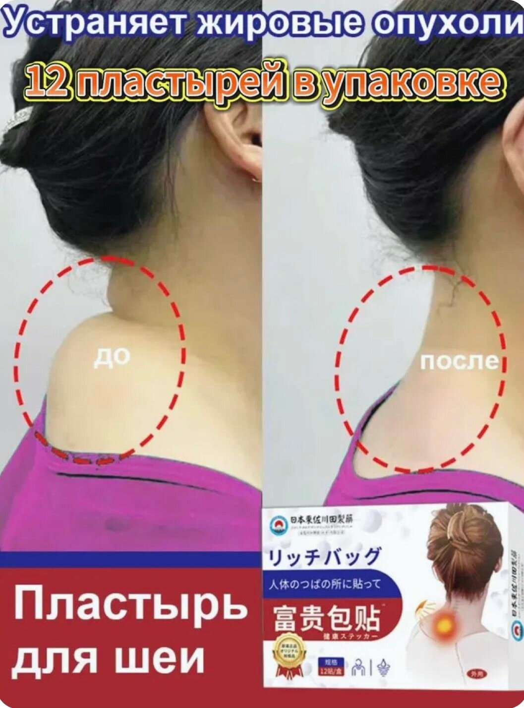 Согревающий пластырь от боли в шее и плечах