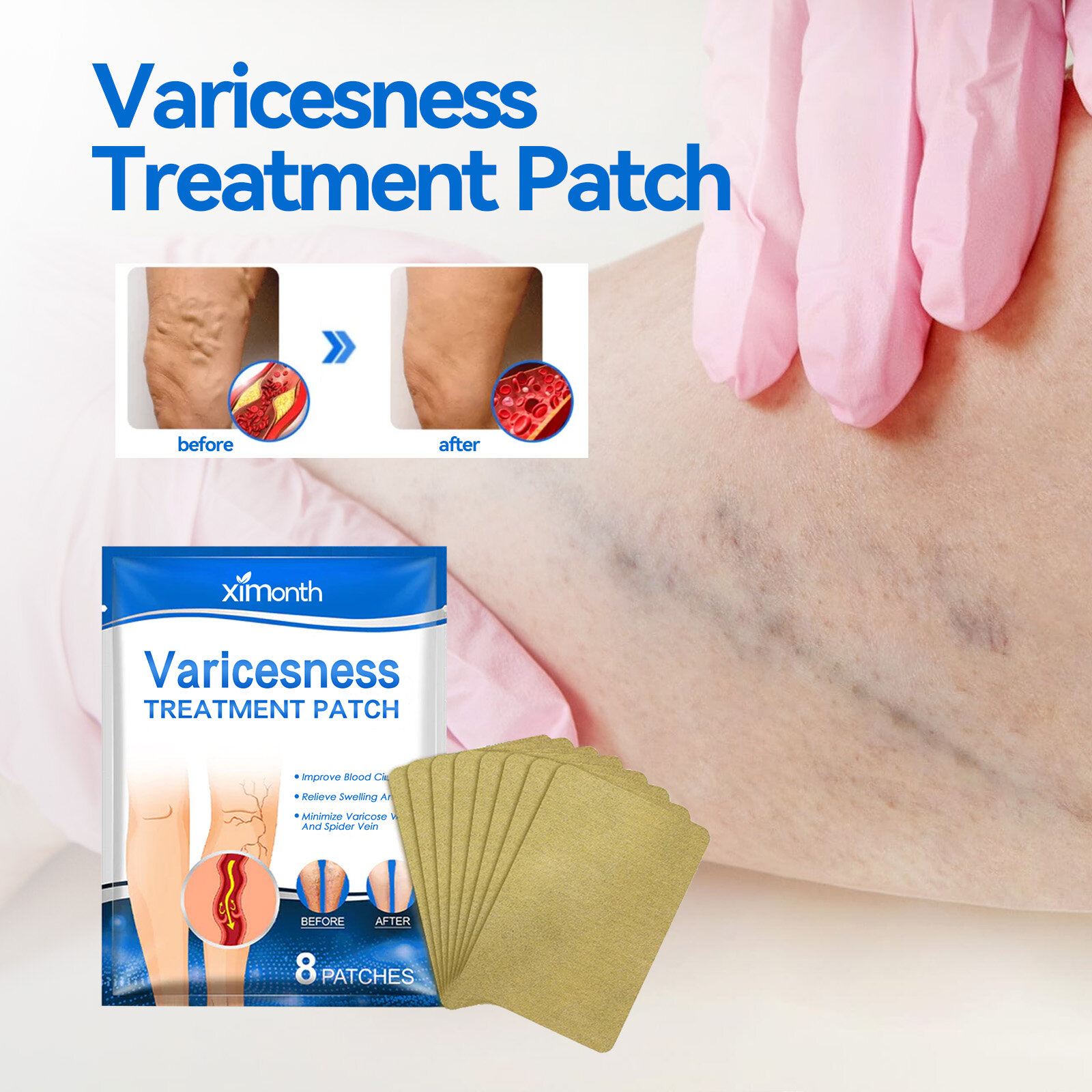 Пластырь для ухода за венами для разглаживания кровеносных сосудов и массажа для облегчения варикозного расширения вен на ногах и отеков лапок дождевых червей