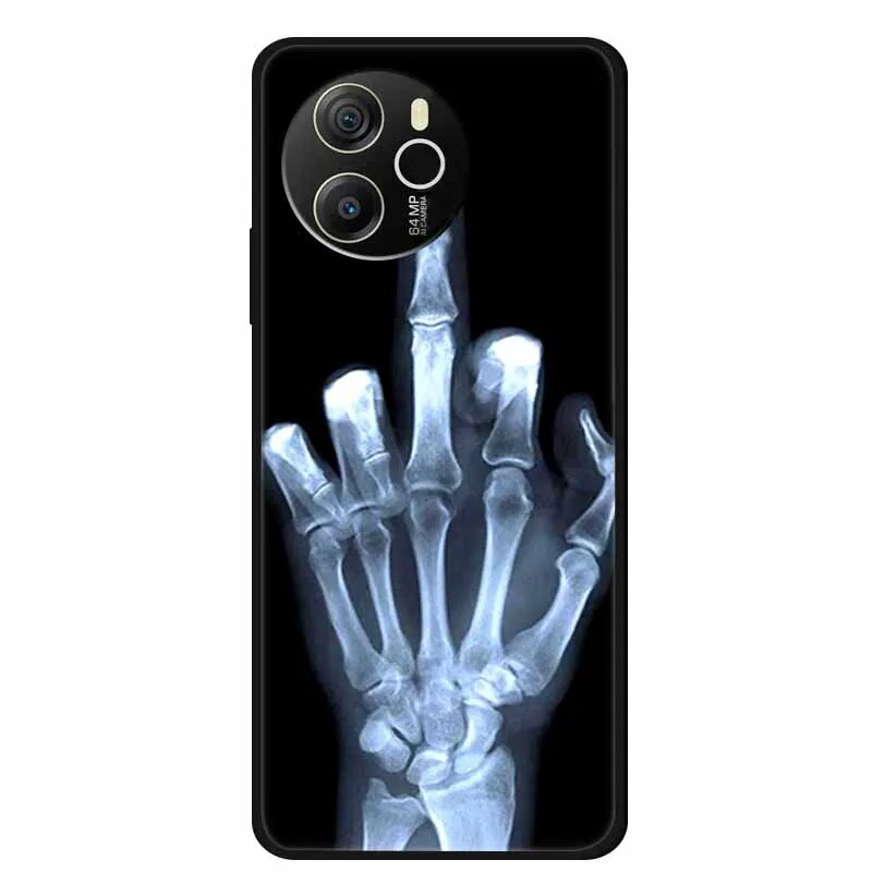 Чехол для Blackview Shark 8 с X-ray рукой, силикон, W101. CH.2