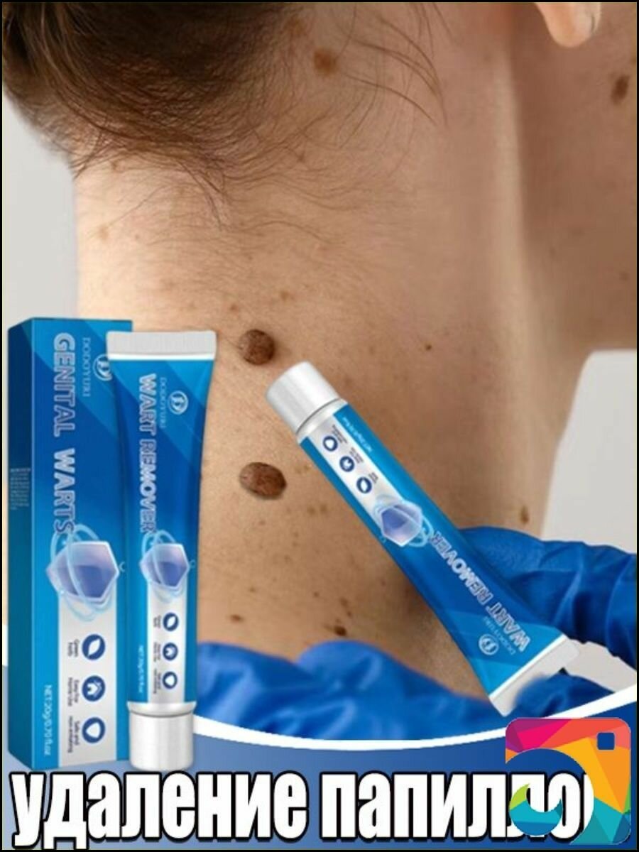 Эксклюзивный крем LUKAOHUA 20 г для деликатного устранения бородавок, папиллом и родинок без следов и побочных реакций