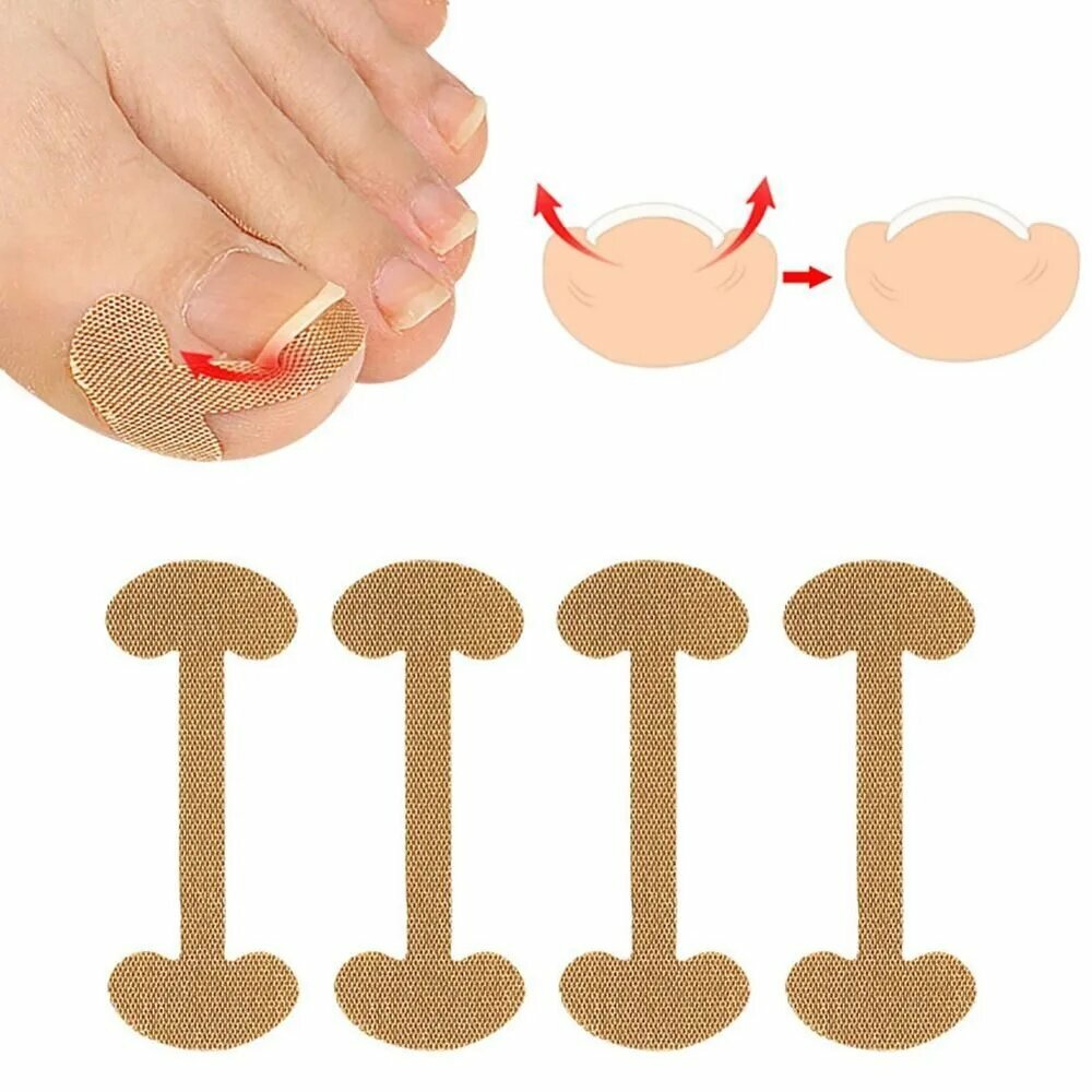 ORTGUT Набор наклеек для коррекции вросших ногтей / Пластырь для исправления пластины при онихокриптозе / Педикюрная корректирующая система для приподнимания ногтя на ноге - 4 шт.