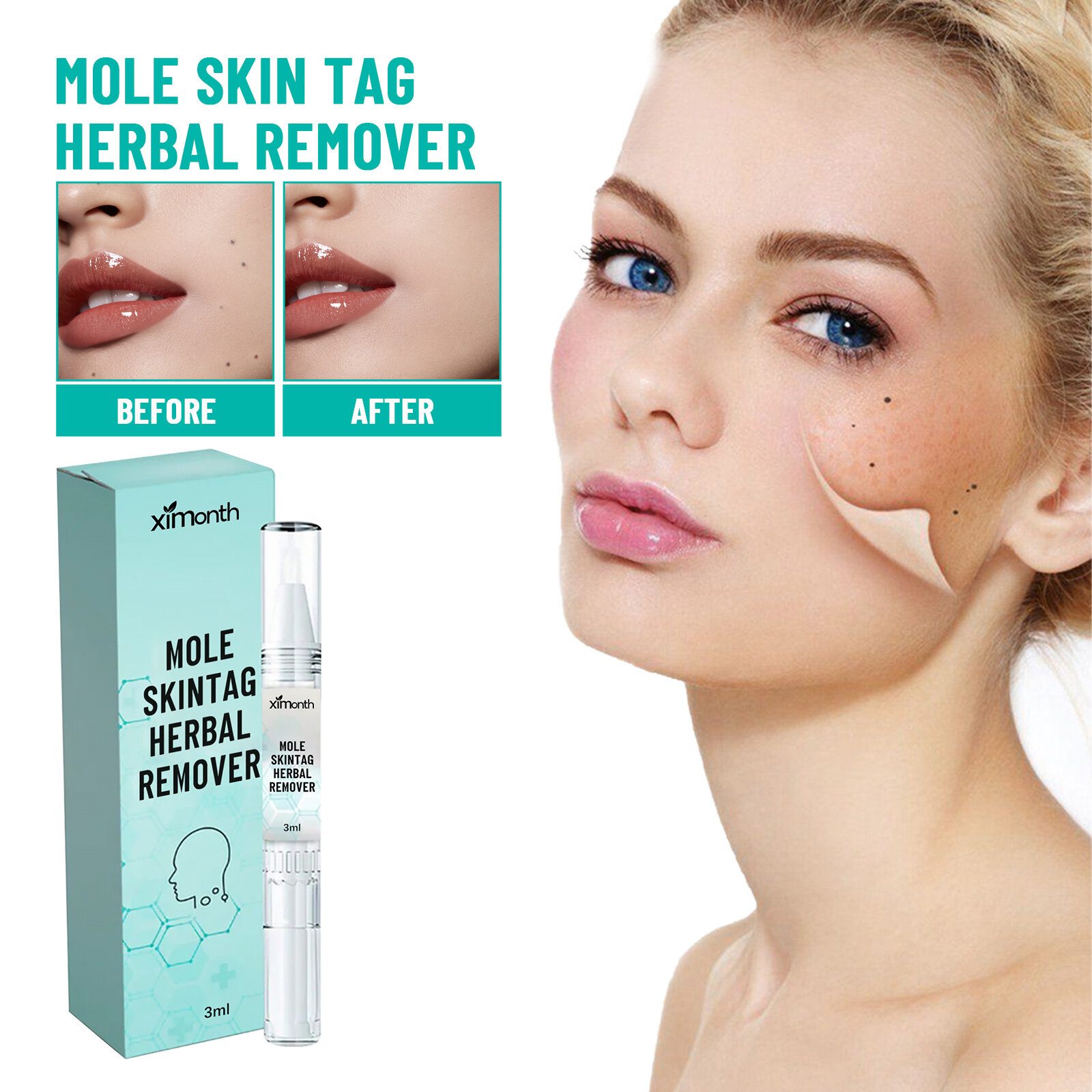 Средство для удаления родинок осветляет кожу, удаляет черные родинки, натоптыши, бородавки и зернистости, очищает и разглаживает кожу, удаляет бородавки и восстанавливает