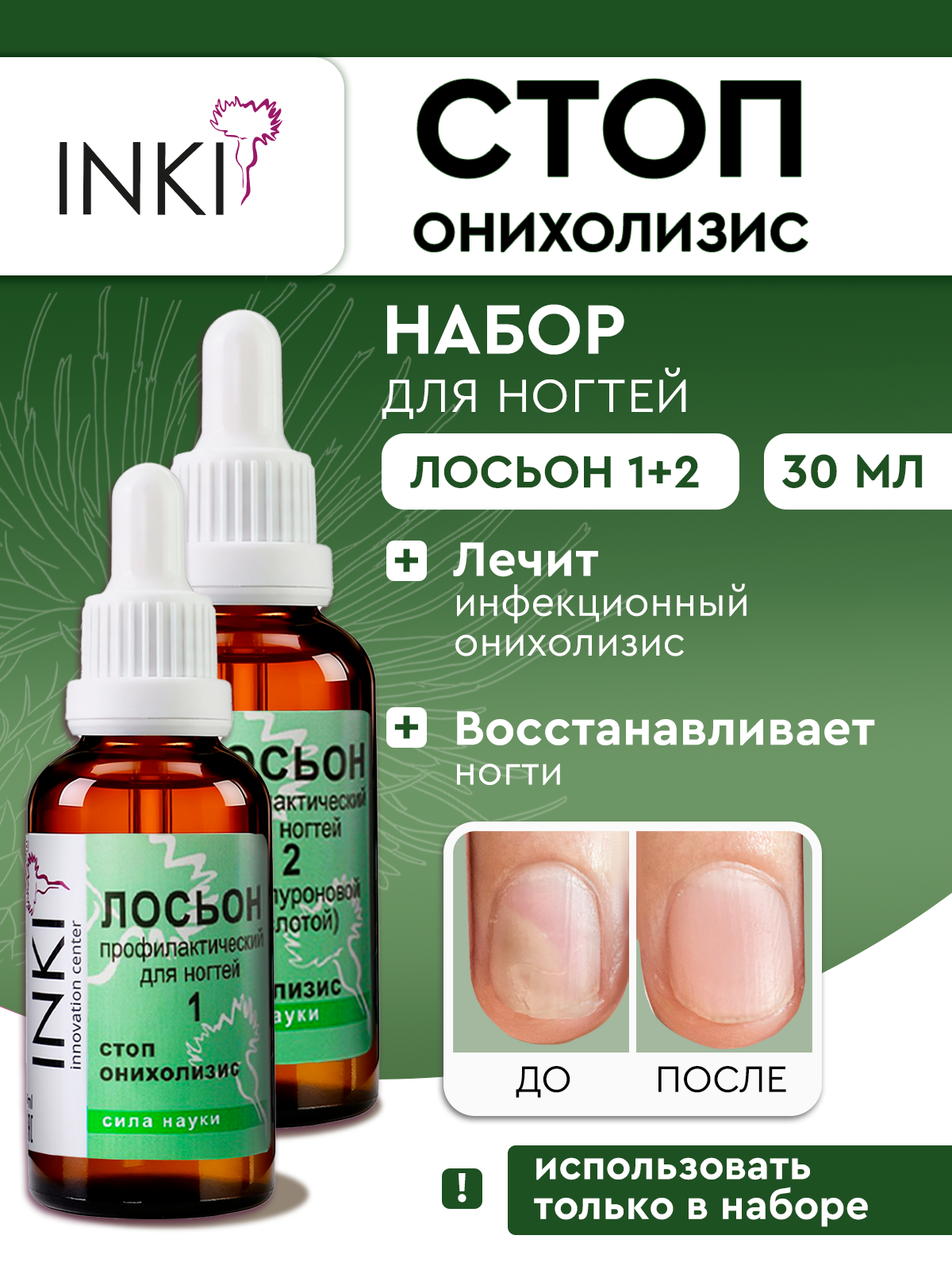 Набор для ухода за ногтями "Стоп Онихолизис" от INKI лосьоны