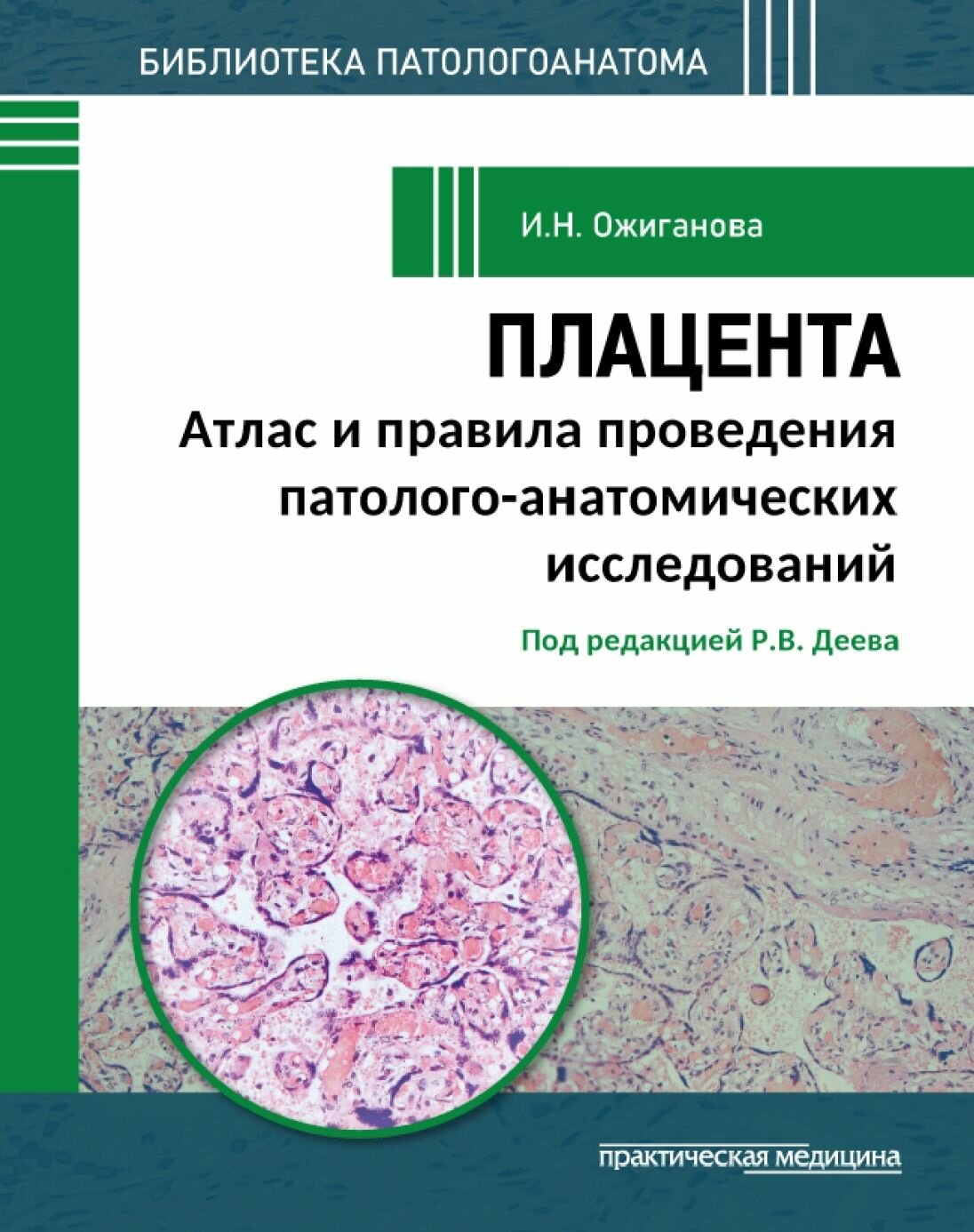 Плацента. Атлас и правила проведения патолого-анатомических исследований