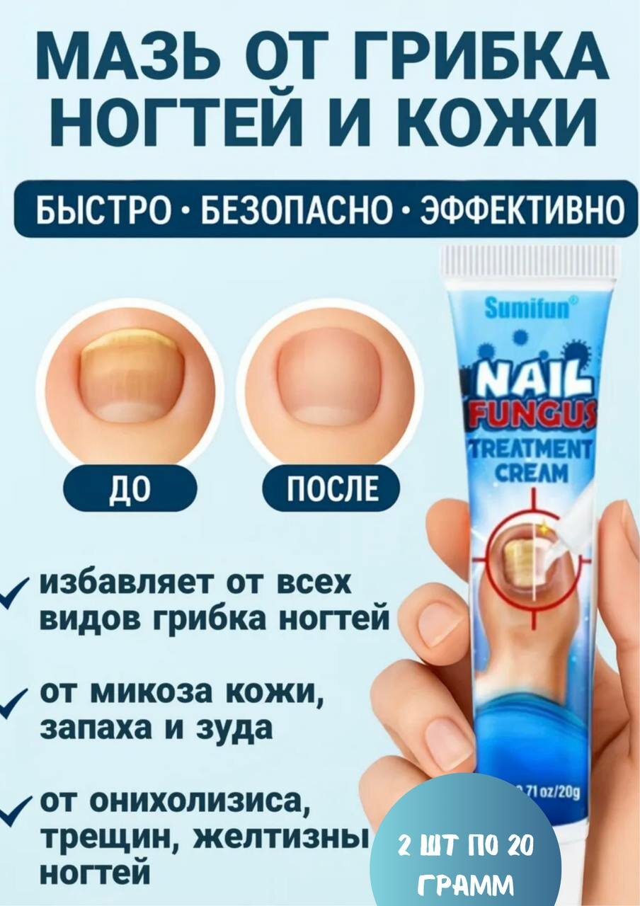 Крем от грибка ногтей Sumifun борьба с несовершенствами. Мазь уход за ногтями и кожей ног. Чудо средство для ухода противогрибковое против онихолизиса